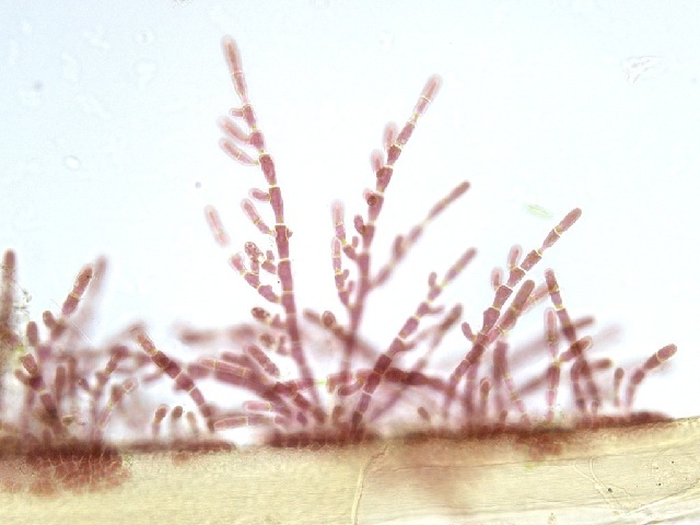 Variety of Life: Acrochaetiales