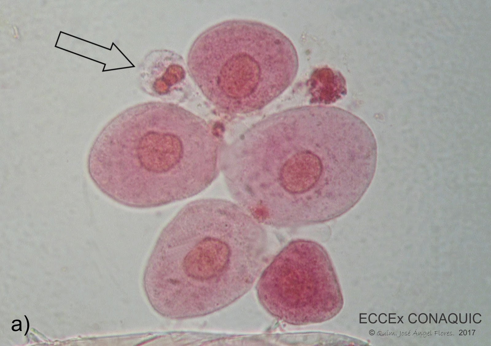 Examen General de Orina: junio 2017