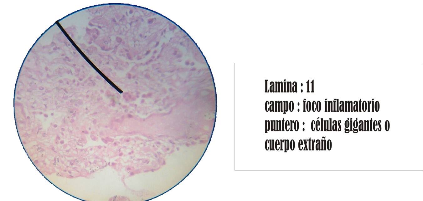 LAMINAS DE TEJIDO CONECTIVO GENERAL