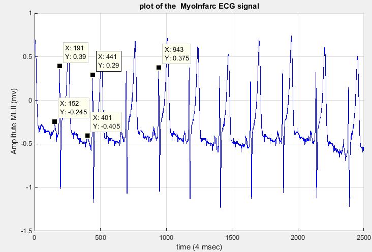 Biomedical Signal and Image Processing projects using Matlab and ...