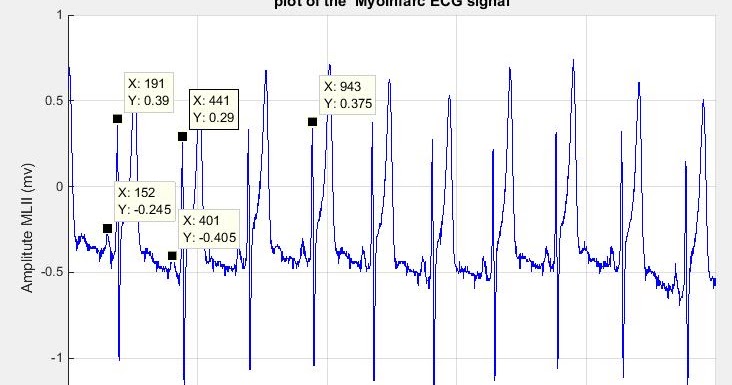 Human activity detection matlab code generator - nextlasopa