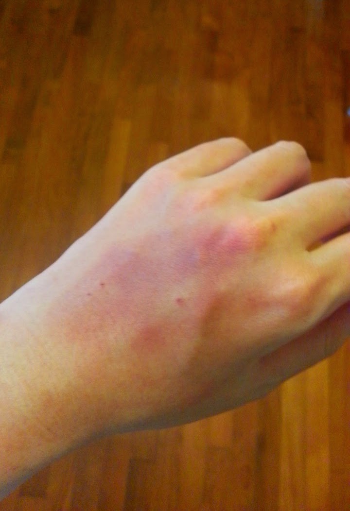 BABY TURTLE: Choking on a Fish Bone