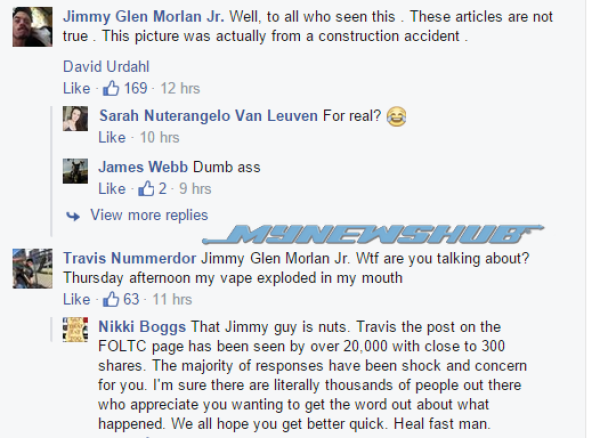 Danger!! VAPE MELETUP DALAM MULUT..!! - PUTRA JEM