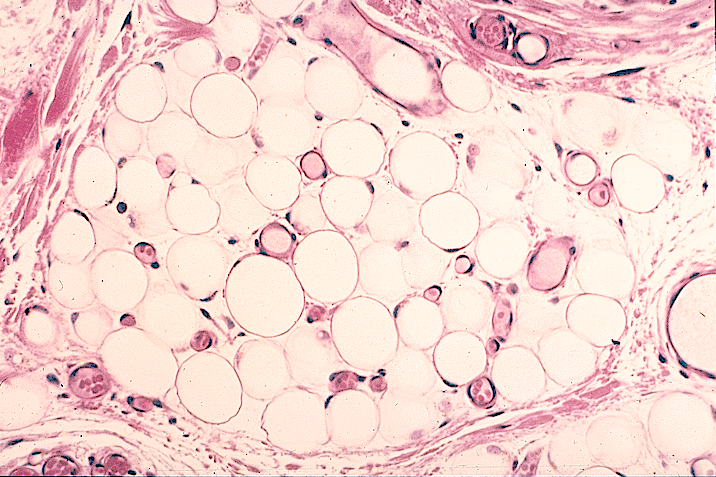 Mikelen txokoa: DBH 3: Bio. Giza ehunak.