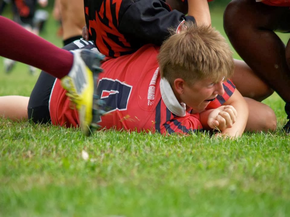The Random Biologist: The Biology Behind Rugby Injuries