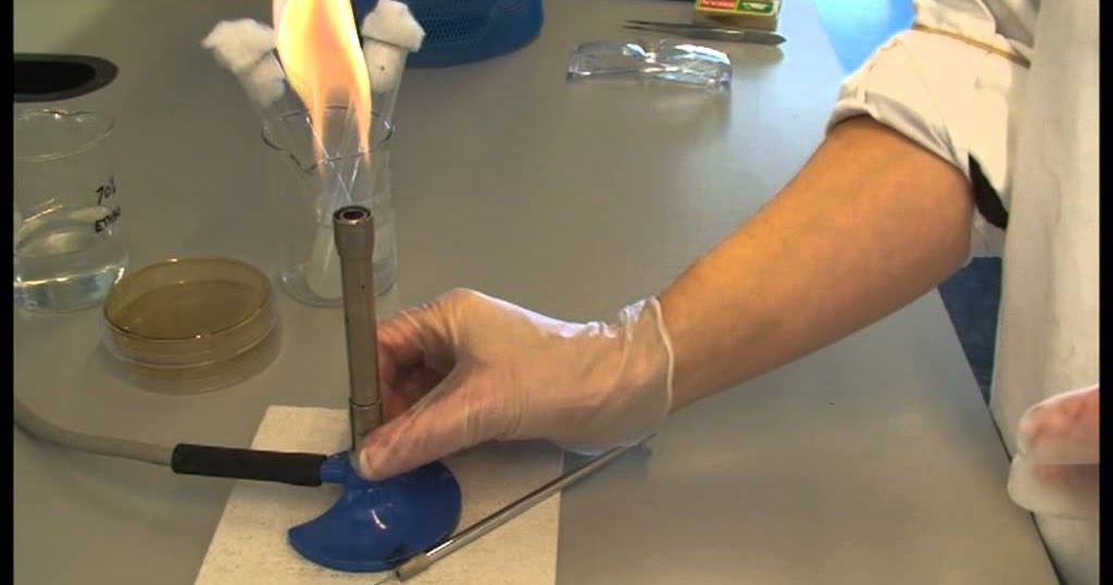 The most known Aseptic Techniques in Microbiology Laboratory - Biology ...