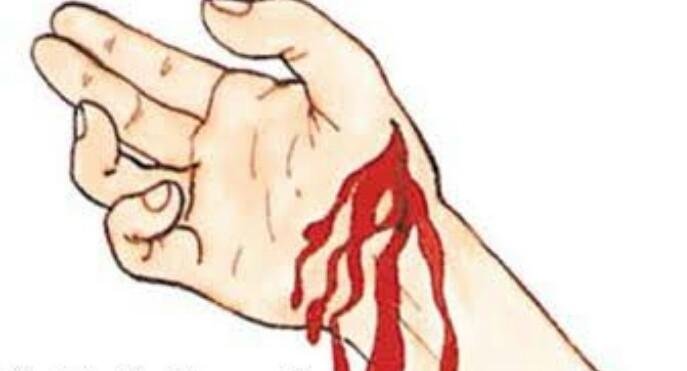 PERDARAHAN dan SYOK - imam khoiruddin