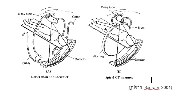 บันทึกของลูกช้างรังสี: หลักการทำงานของ Spiral CT.