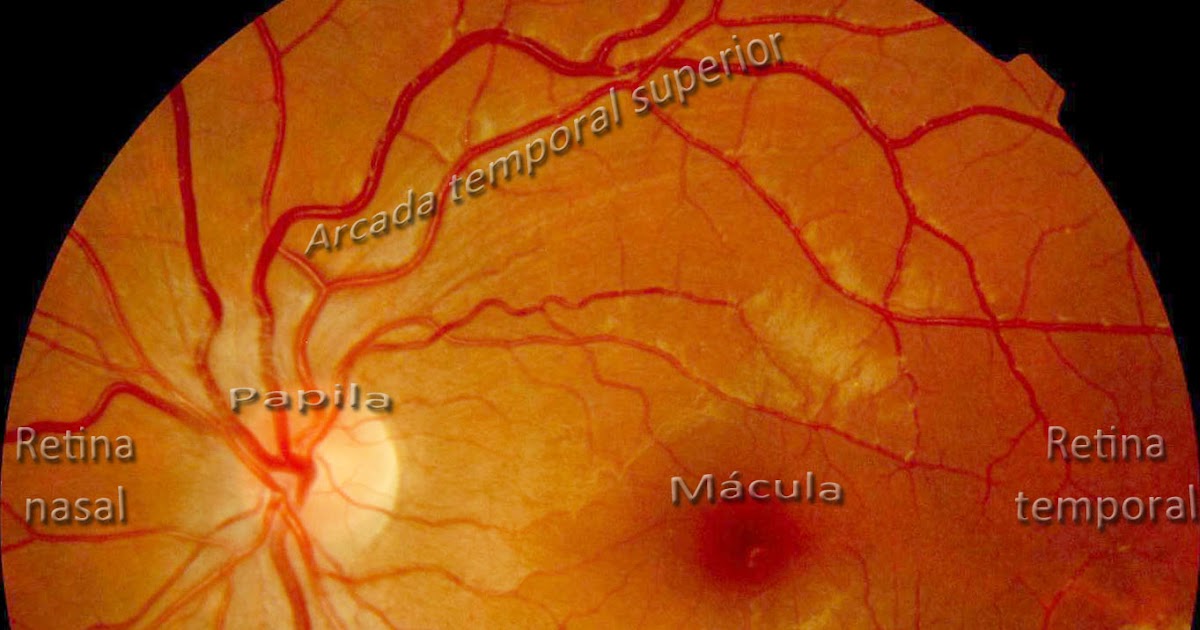 ESPACIO RETINA: Retinografía normal.