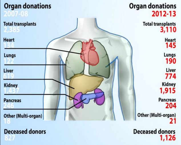 Kaedah Fiqh Dalam Pendermaan Dan Pemindahan Organ Kaedah Fiqh Dalam Pendermaan Dan Pemindahan Organ