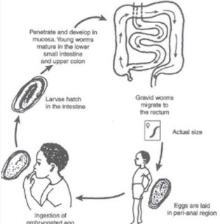 Medical Natural Pinworm | medical natural