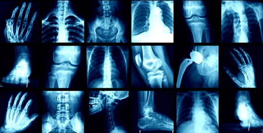 Radiological Physician Associates Announces Cloud Imaging for West ...