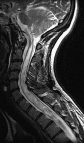 March 2016-Mayo Radiology