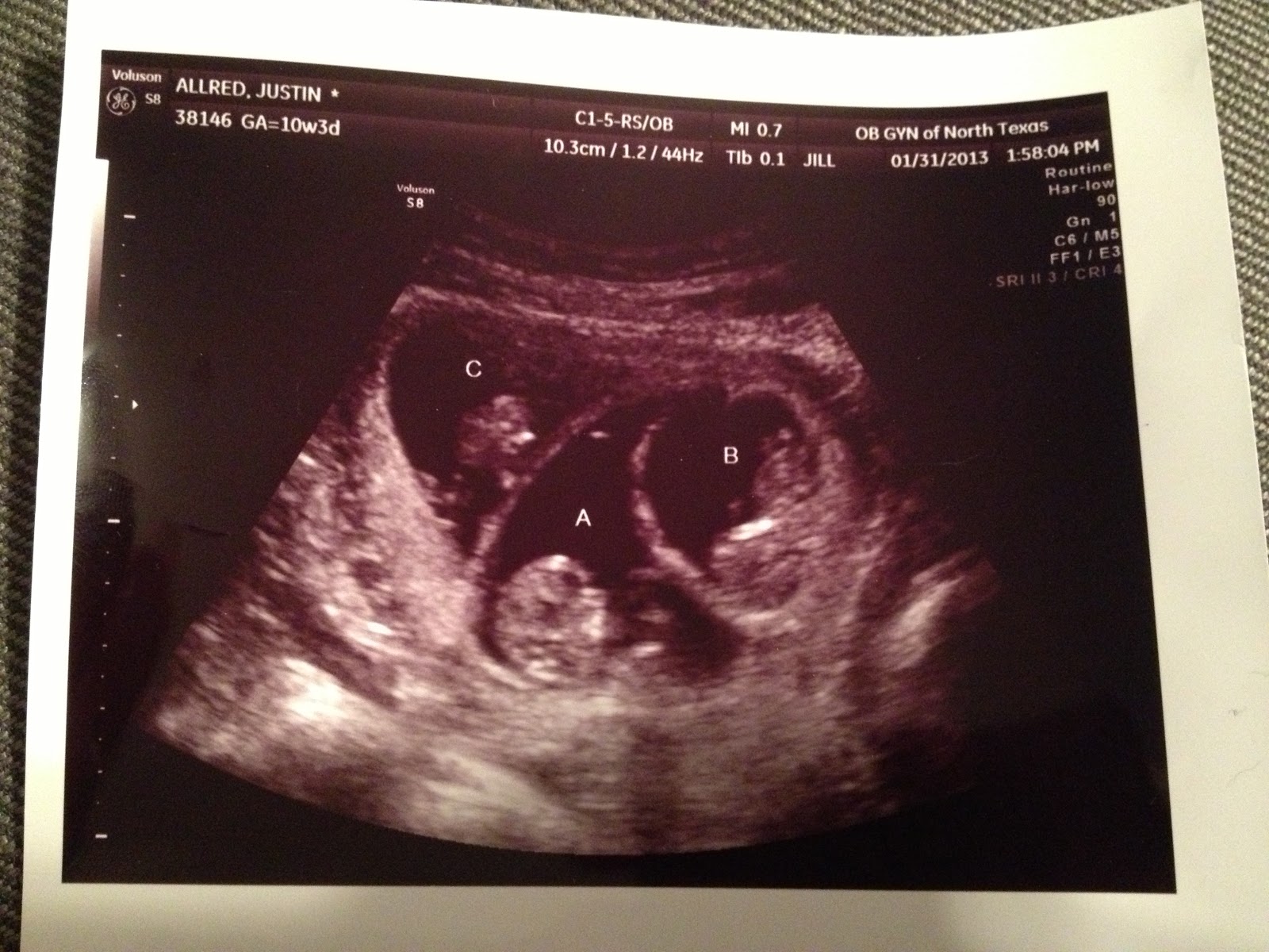 The Allred's: The Triplet Details!!