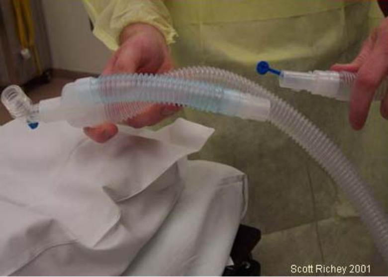 FREMITUS: Inhaled Nitric Oxide Set-up for Cardiac Surgery