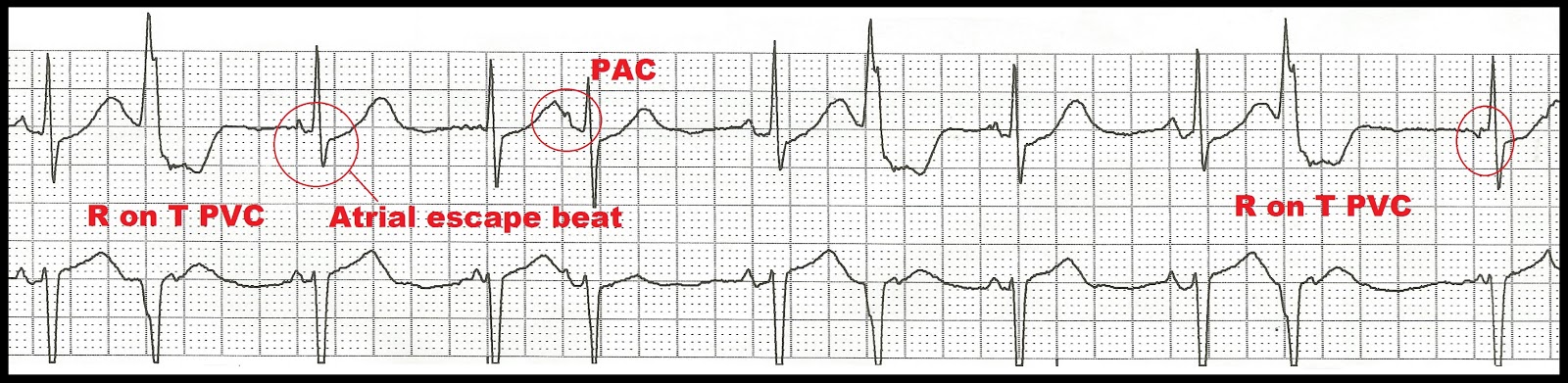 Practice EKG Rhythm Strips 149