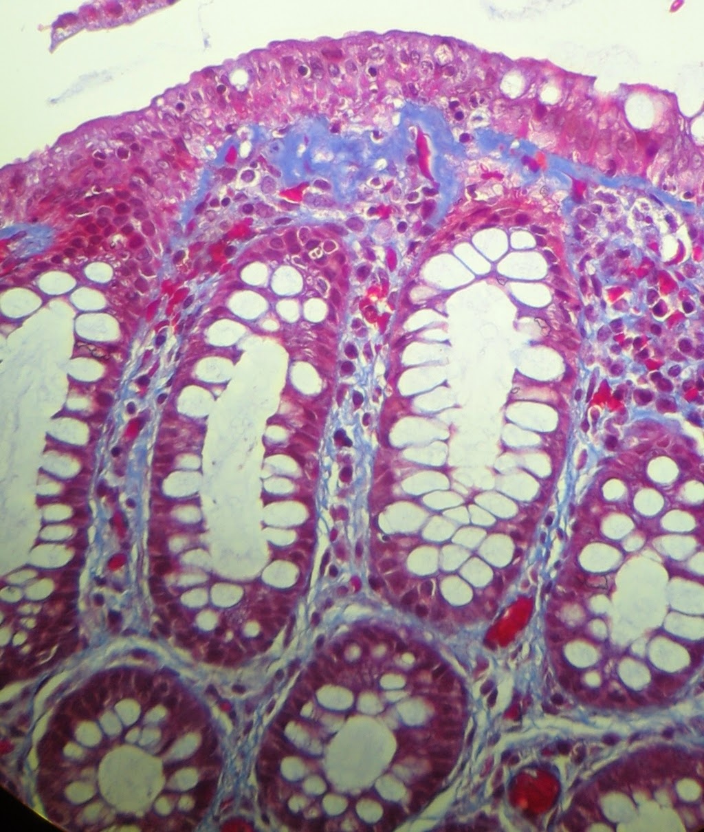 GASTROINTESTINAL AND LIVER HISTOLOGY PATHOLOGY ATLAS: COLON ...