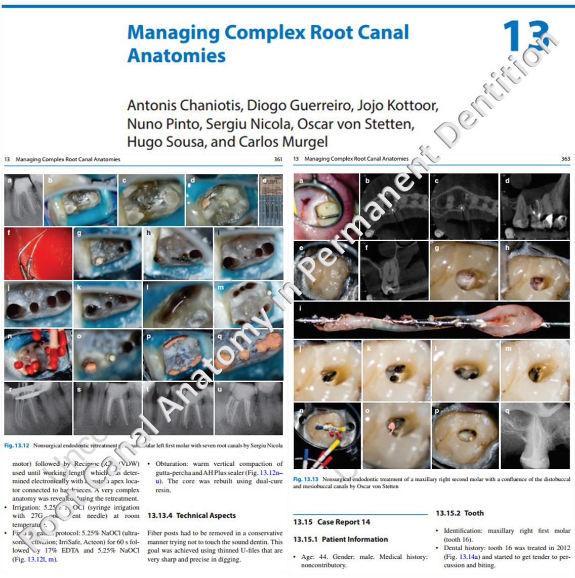 The Root Canal Anatomy Project: 2018