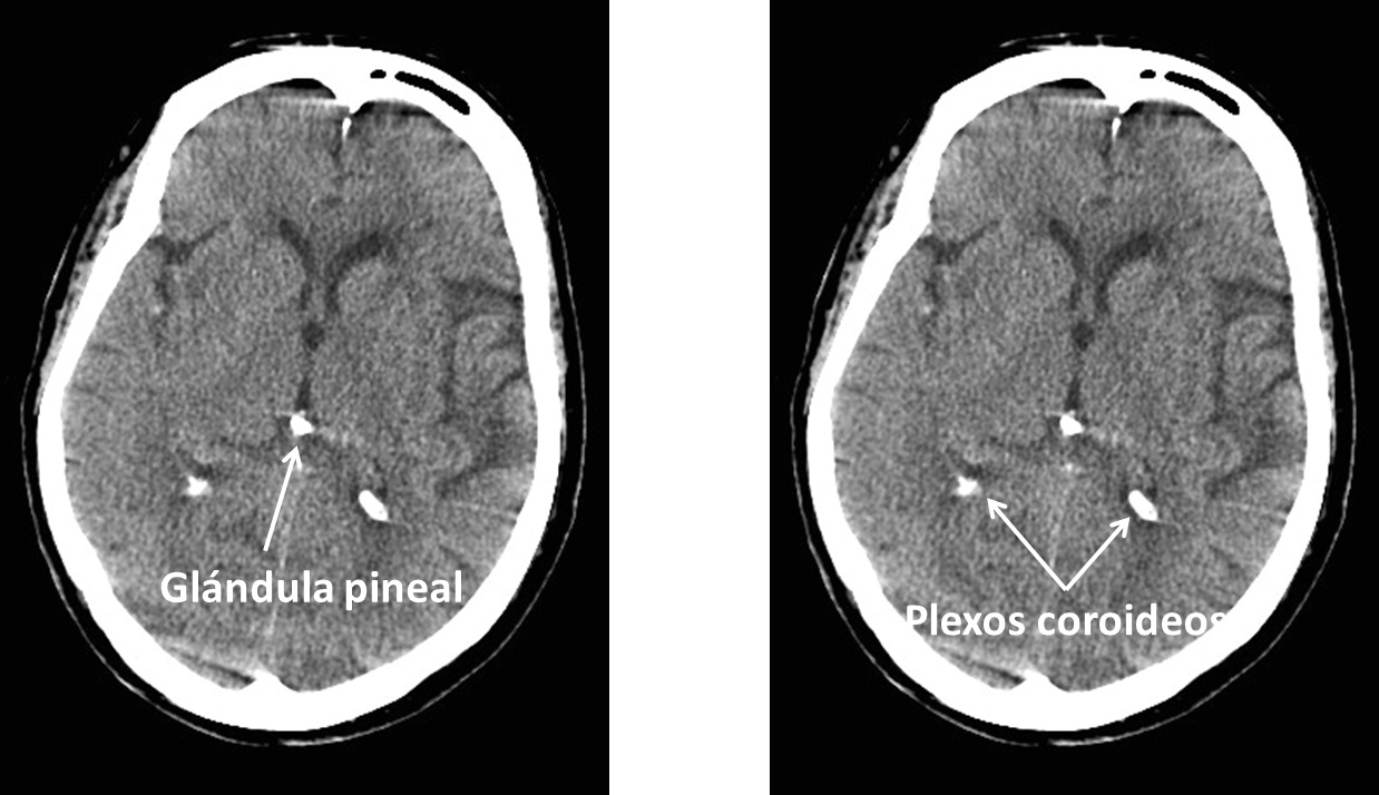 Anatomía: octubre 2015