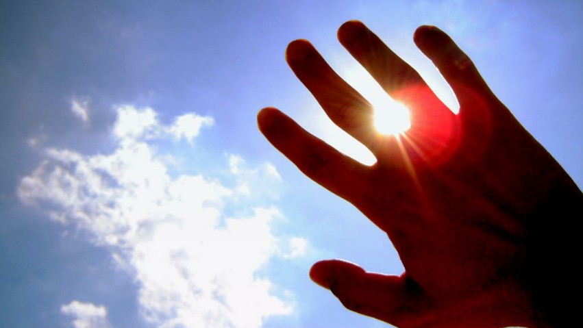 MBBS BHAI: WHAT IS SKIN HYPERPIGMENTATION | SKIN TANNING