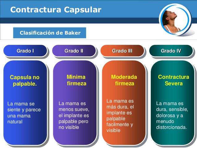 cemuvenezuela: CONTRACTURA CAPSULAR