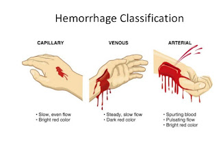 PATHOLOGY: HEMORRHAGE