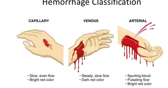 PATHOLOGY: HEMORRHAGE