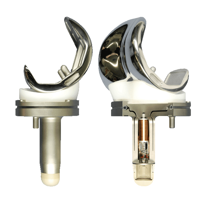 Weighty Matters: Knee Replacement Surgeries Should Not Be Precluded By ...