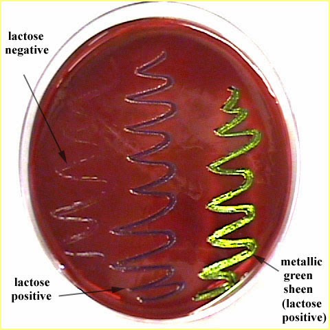 Agar EMB | Anecdotas del Laboratorio