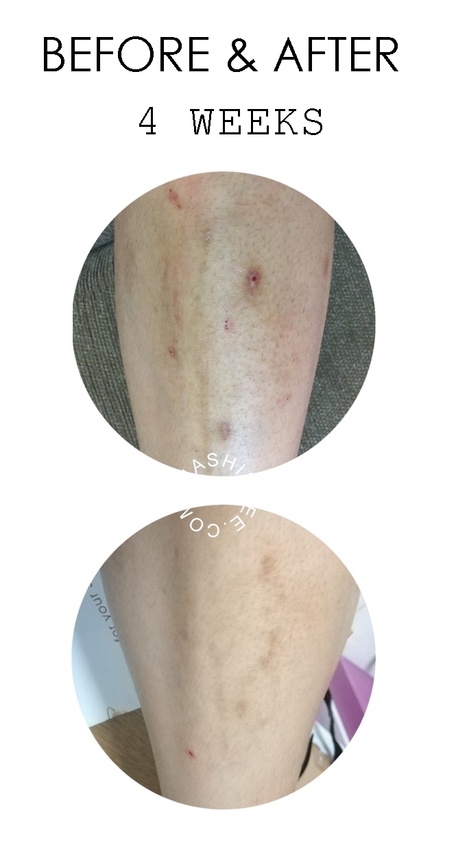 Beta Skin Natural Active Cream Review - Jia Shin Lee