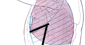 松下 ER ランチ・カンファレンス: トラウベの三角形 Traube's space