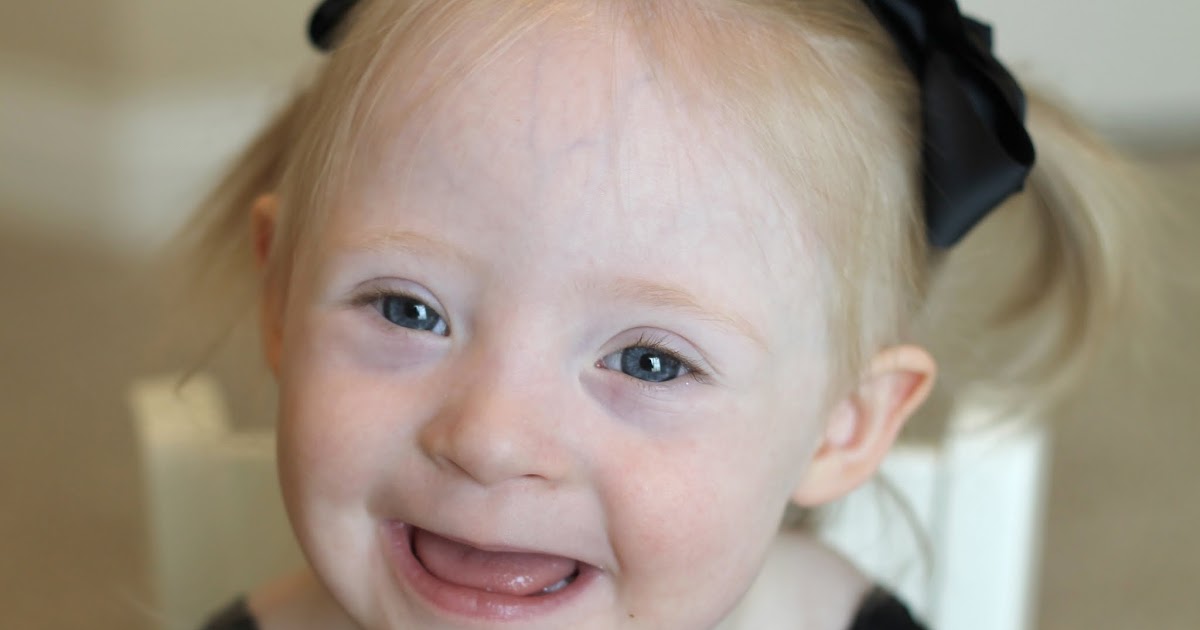 Confessions of the Chromosomally Enhanced: Precious Faces