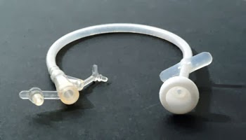 Cancer Fun Time!: Tubectomy