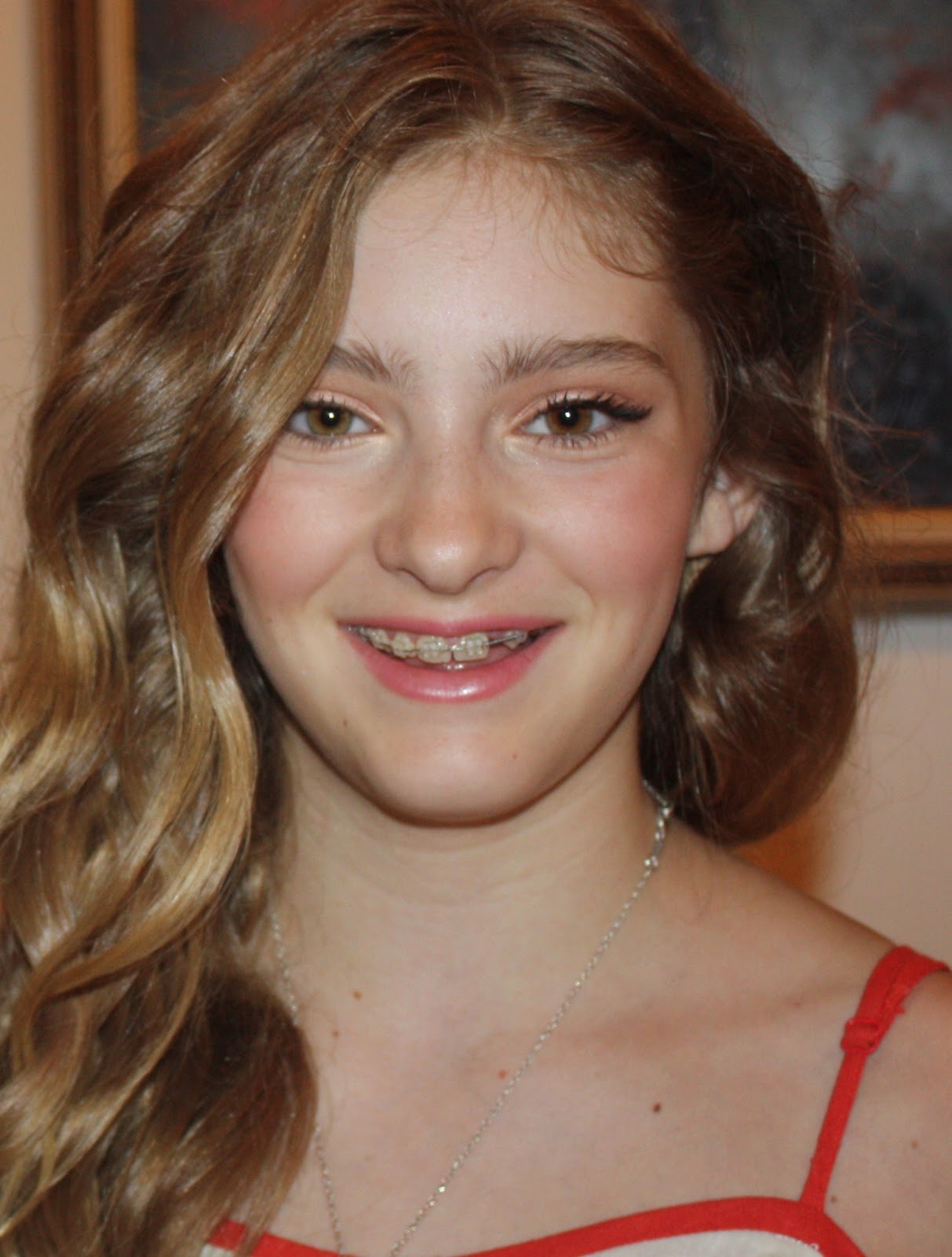 Willow Shields Braces
