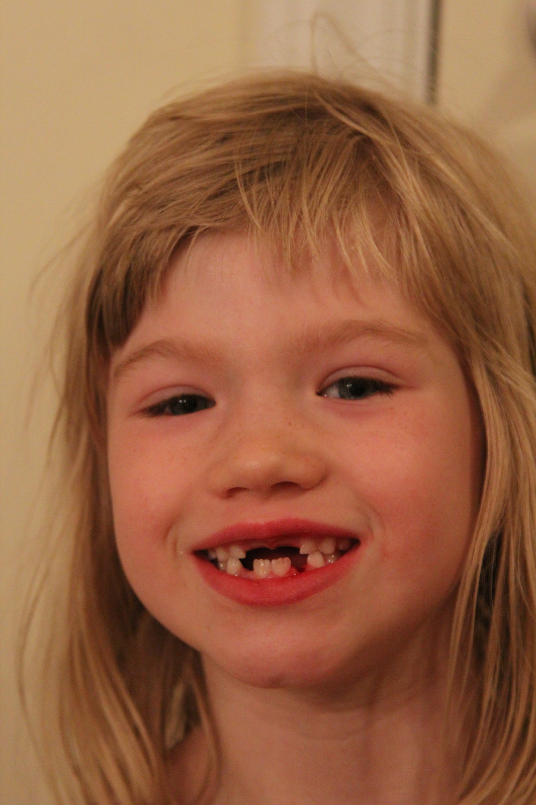 The Poco Loco Olsons: Toothless in Seattle: Annika's 6th lost tooth