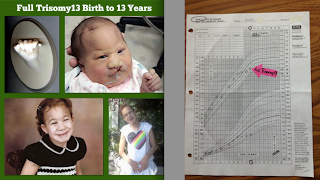 Trisomy 13 Life with Natalia ~ Transformed by Love: Natalia is ...