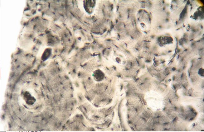 Morfofisiológia 1: Tejido oseo (Histología)