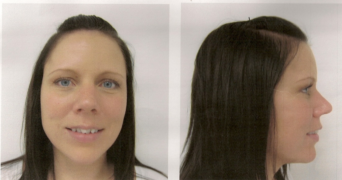 Brace Face: Taking the plunge