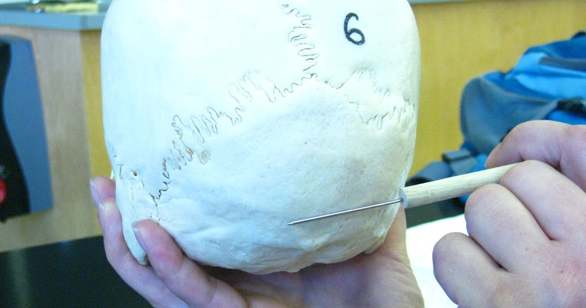 Boned: Human Skull - superior nuchal line (of occipital bone)