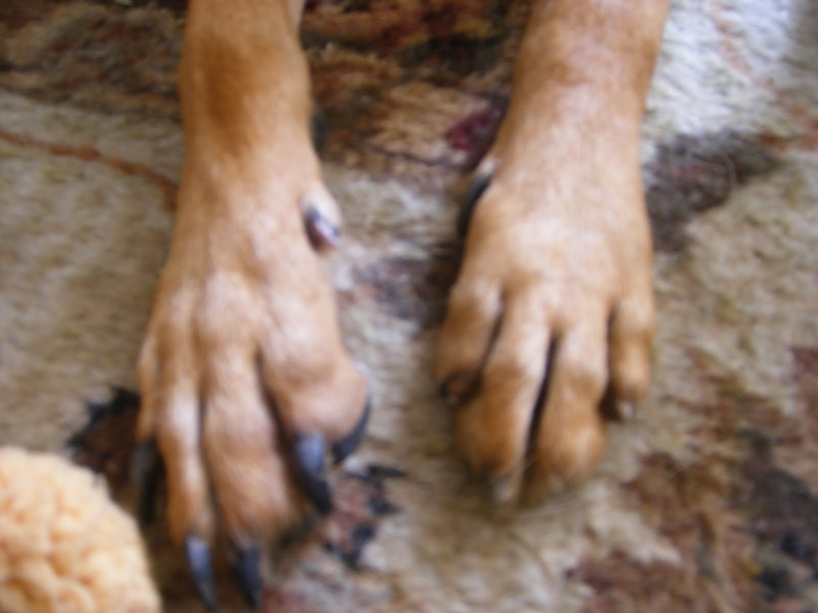 Amazing Grace: SYMMETRICAL LUPOID ONYCHODSTROPHY