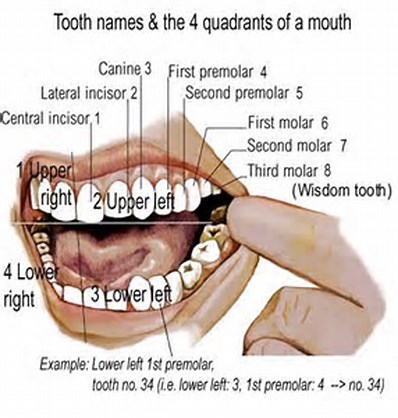 The Tales of a Stroke Patient and More: This Is a Life Lesson ...