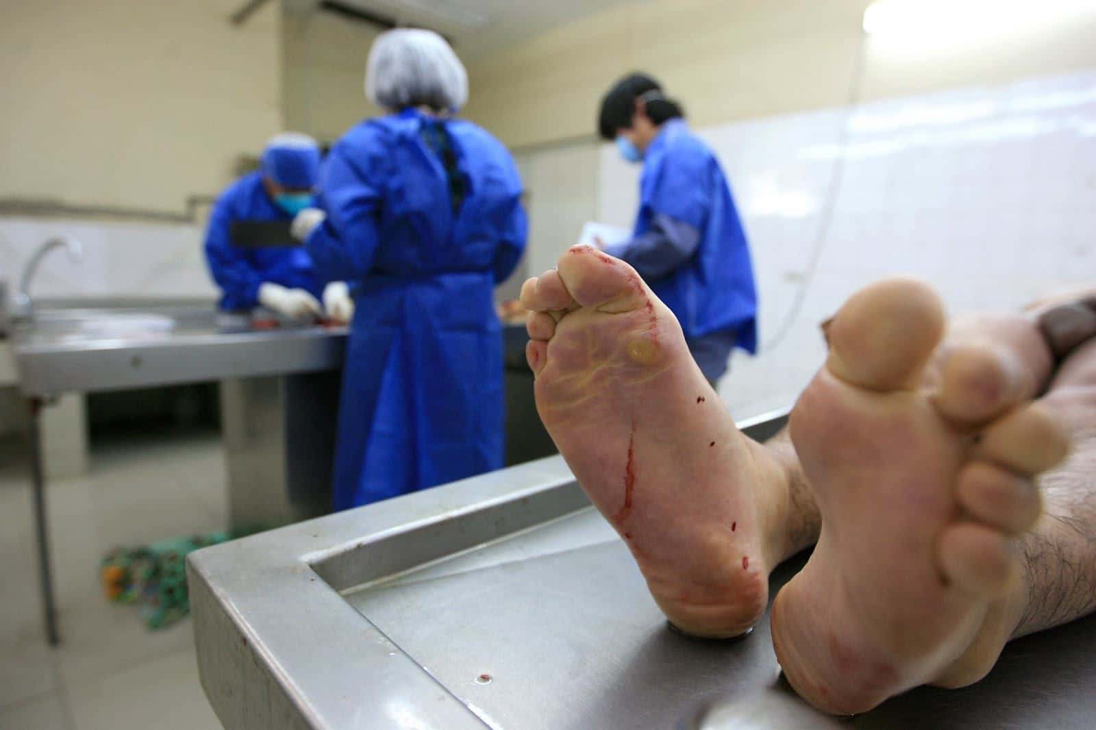 Medicina Forense: Medicina Forense