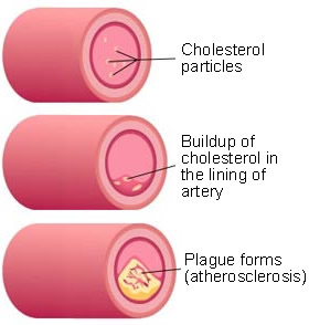 WHAT IS CHOLESTEROL?