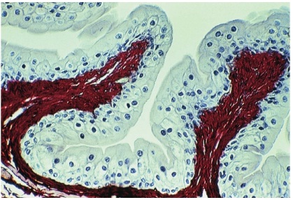 Médicos do Futuro: Urotélio