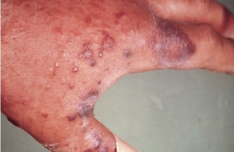 [Microbiology] Atlas of Zoonotic Diseases | Free Medical Atlas