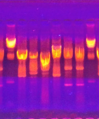 ¡Bacteriology! : ELECTROFORESIS