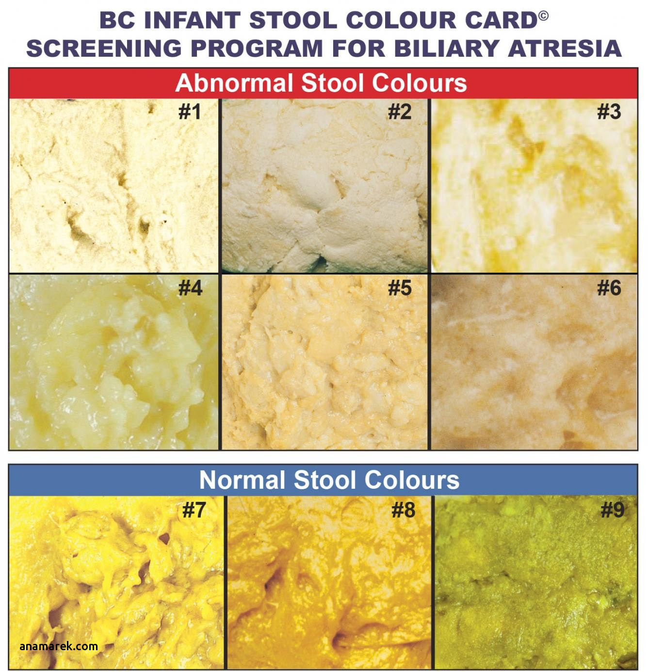 warna najis baby normal - Jennifer Short