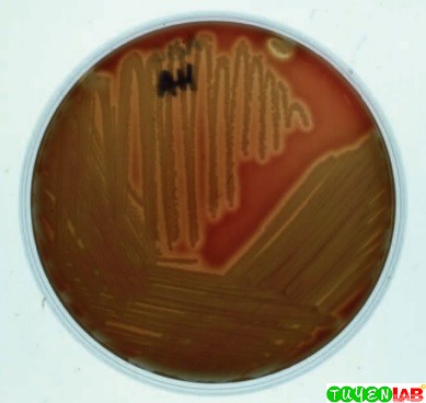 [Microbiology] Atlas of Vibrio, Aeromonas, Plesiomonas, and ...