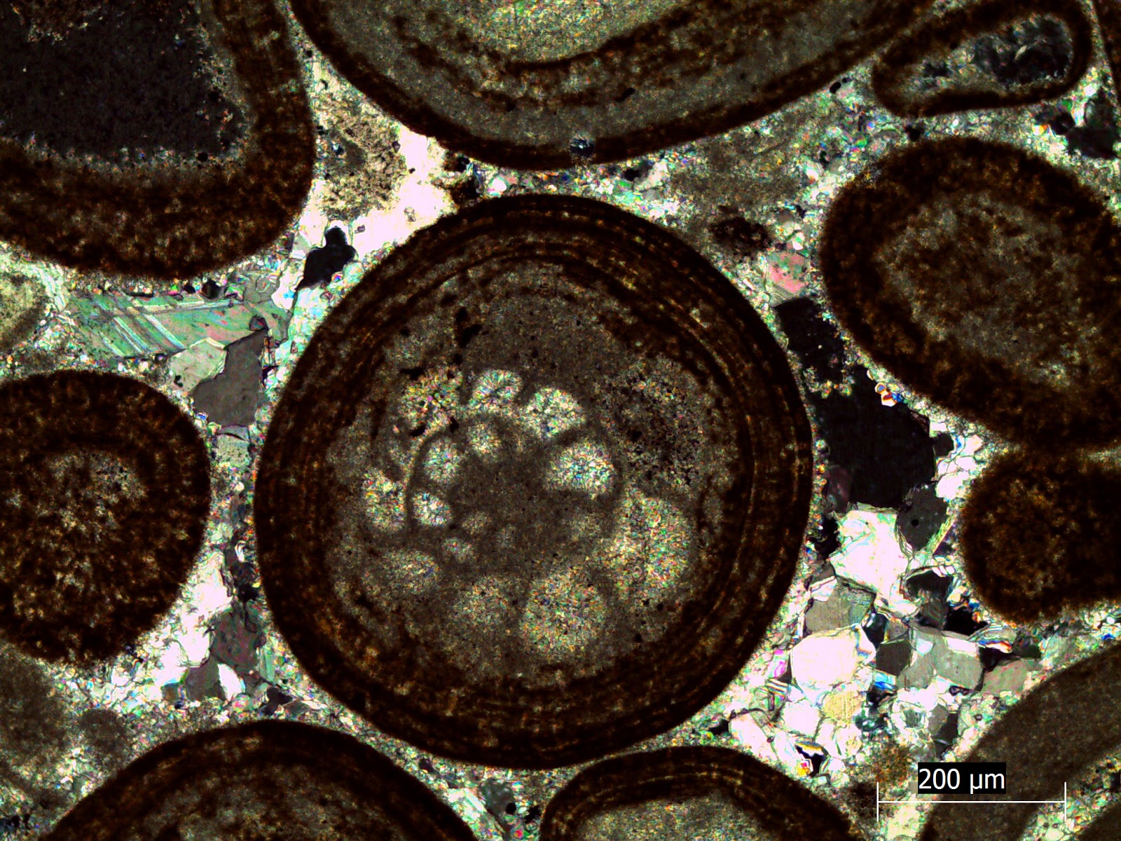 Rapid Uplift: Photomicrograph- Ooid Growth Over A Foraminifera Nucleus