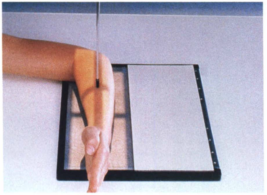 Gudang Medis: teknik radiografi antebrachii